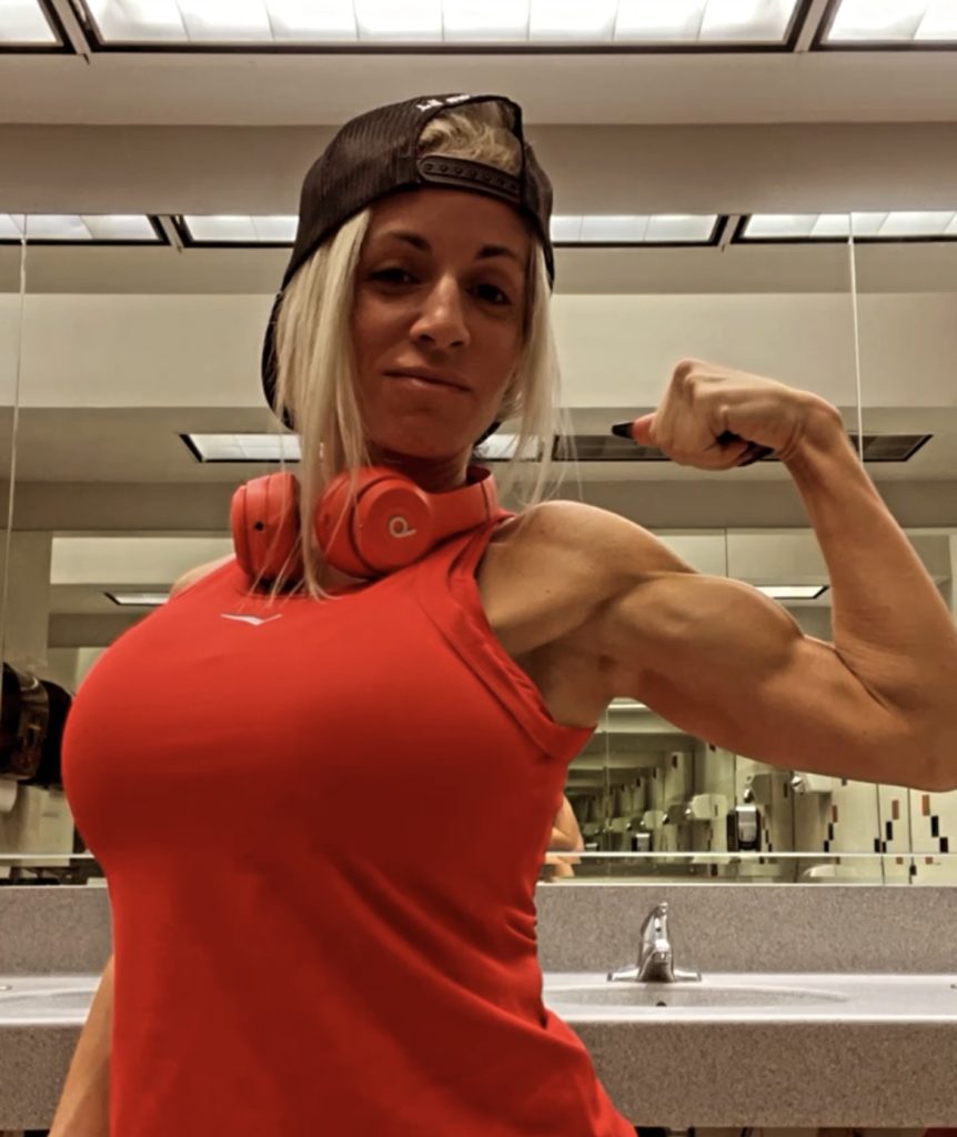 Woman Forced to Remove Breast Implant After Sepsis, Faces Body Shaming ...